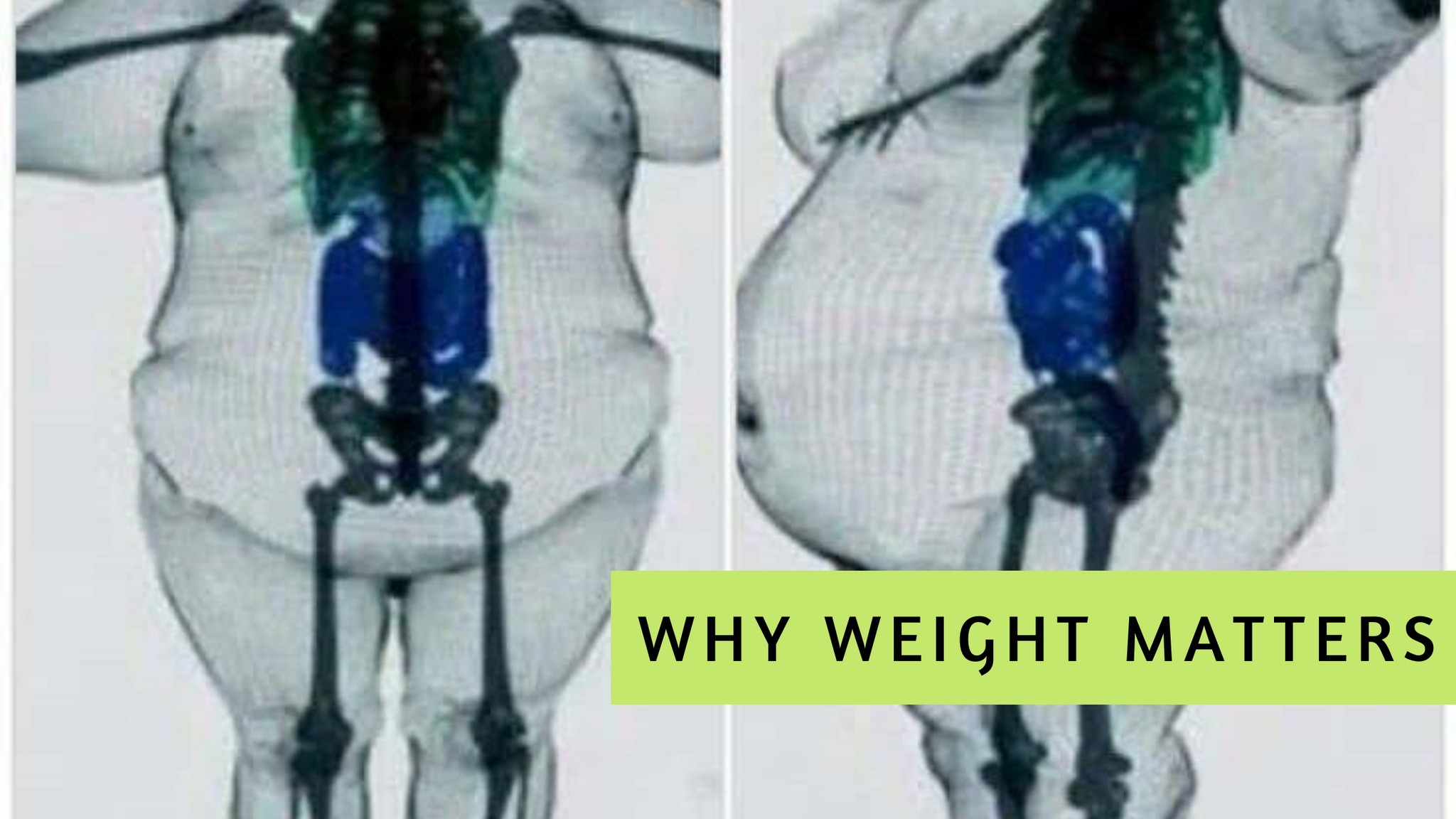 Why weight matters - Not just on the scale, but inside your body